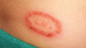 My 15 year old son been at his Nanny house for the weekend and he came ...